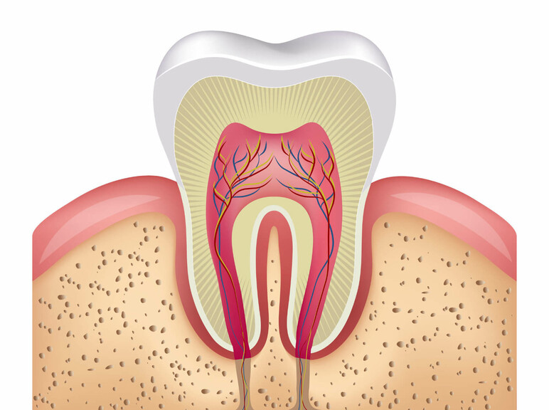 Apikale Parodontitis | Eckhauspraxis